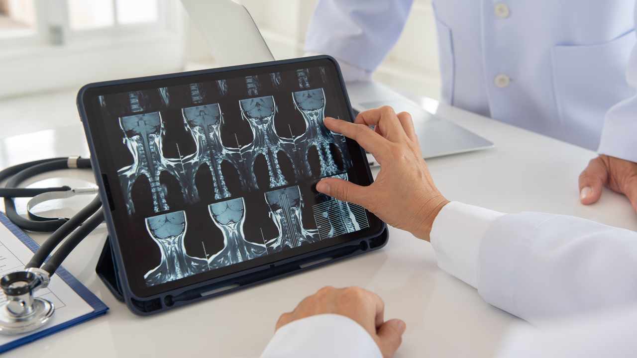 The Brain & Spine Institute | UConn Health